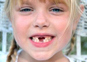 Best Dental Clinic in South Delhi - Best Dentist in South Delhi